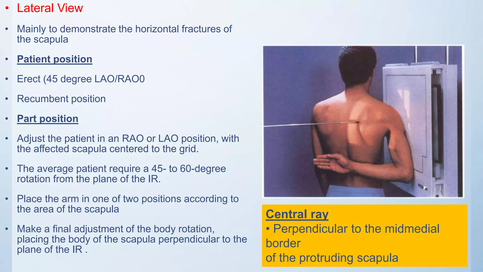 X ray views of shoulder joint and related structures | PPTX