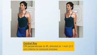 X ray views of shoulder joint and related structures | PPTX