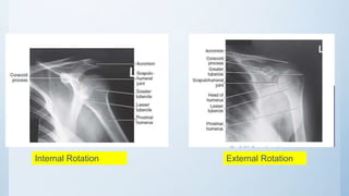 X ray views of shoulder joint and related structures | PPTX