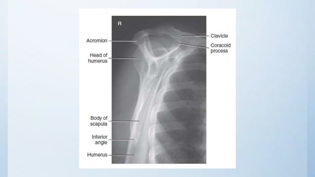 X ray views of shoulder joint and related structures | PPTX