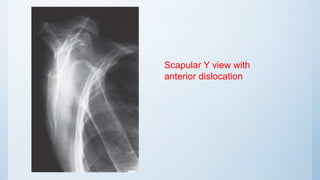 X ray views of shoulder joint and related structures | PPTX
