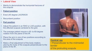 X ray views of shoulder joint and related structures | PPTX