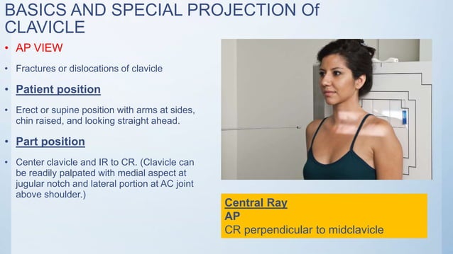X ray views of shoulder joint and related structures | PPTX