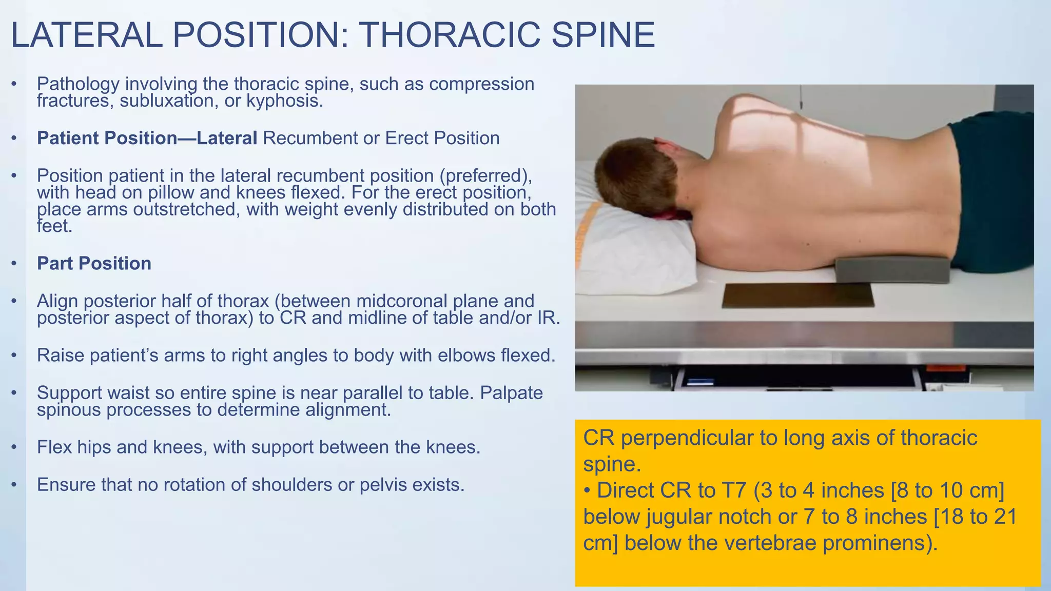 Radiographic views of thoracic spine | PPTX