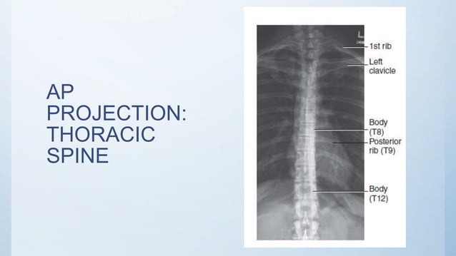 Radiographic views of thoracic spine | PPTX