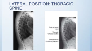 Radiographic views of thoracic spine | PPTX