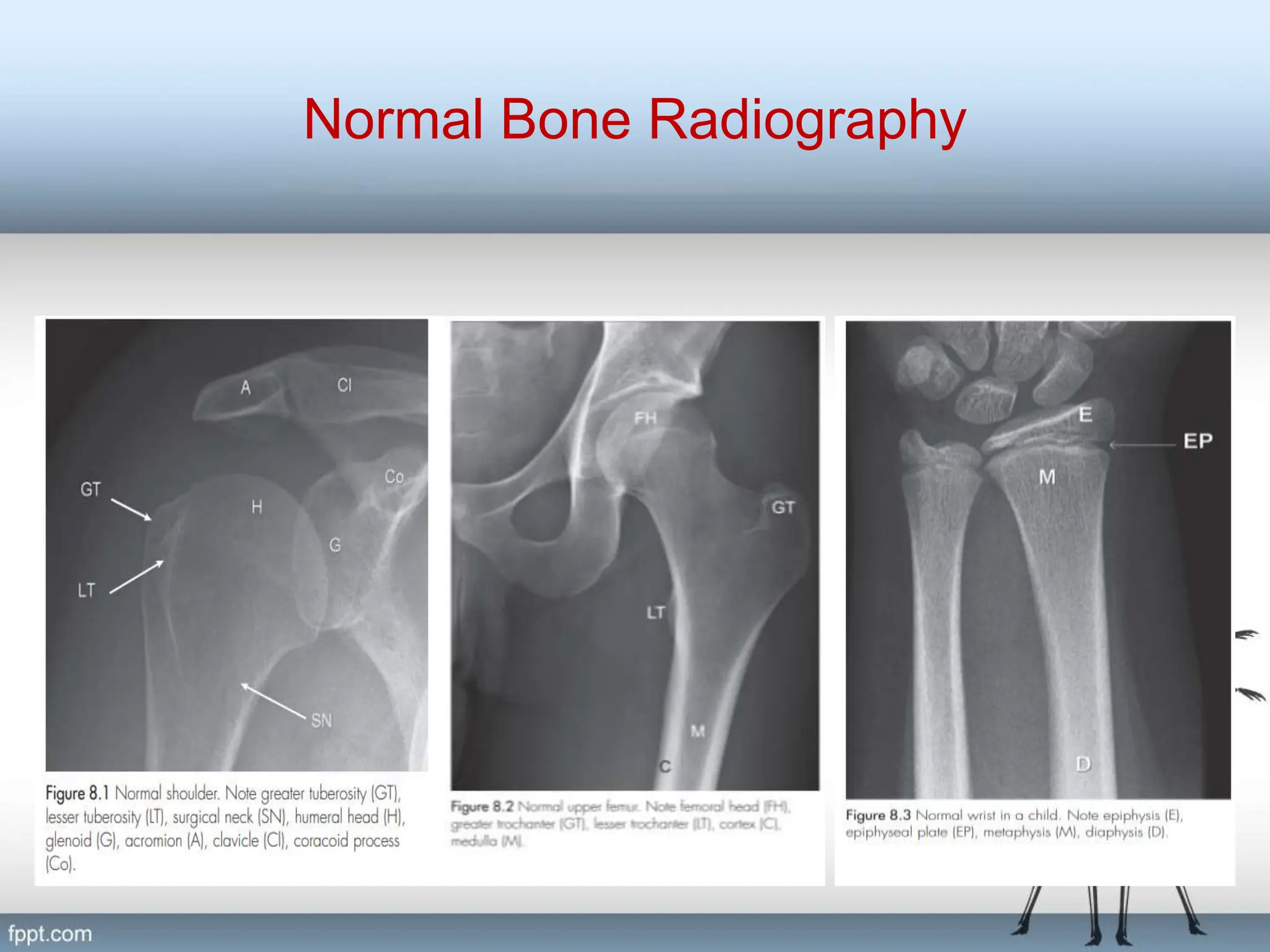 Radiograph of Skeletal System.pptmmmmmmmm | PPT