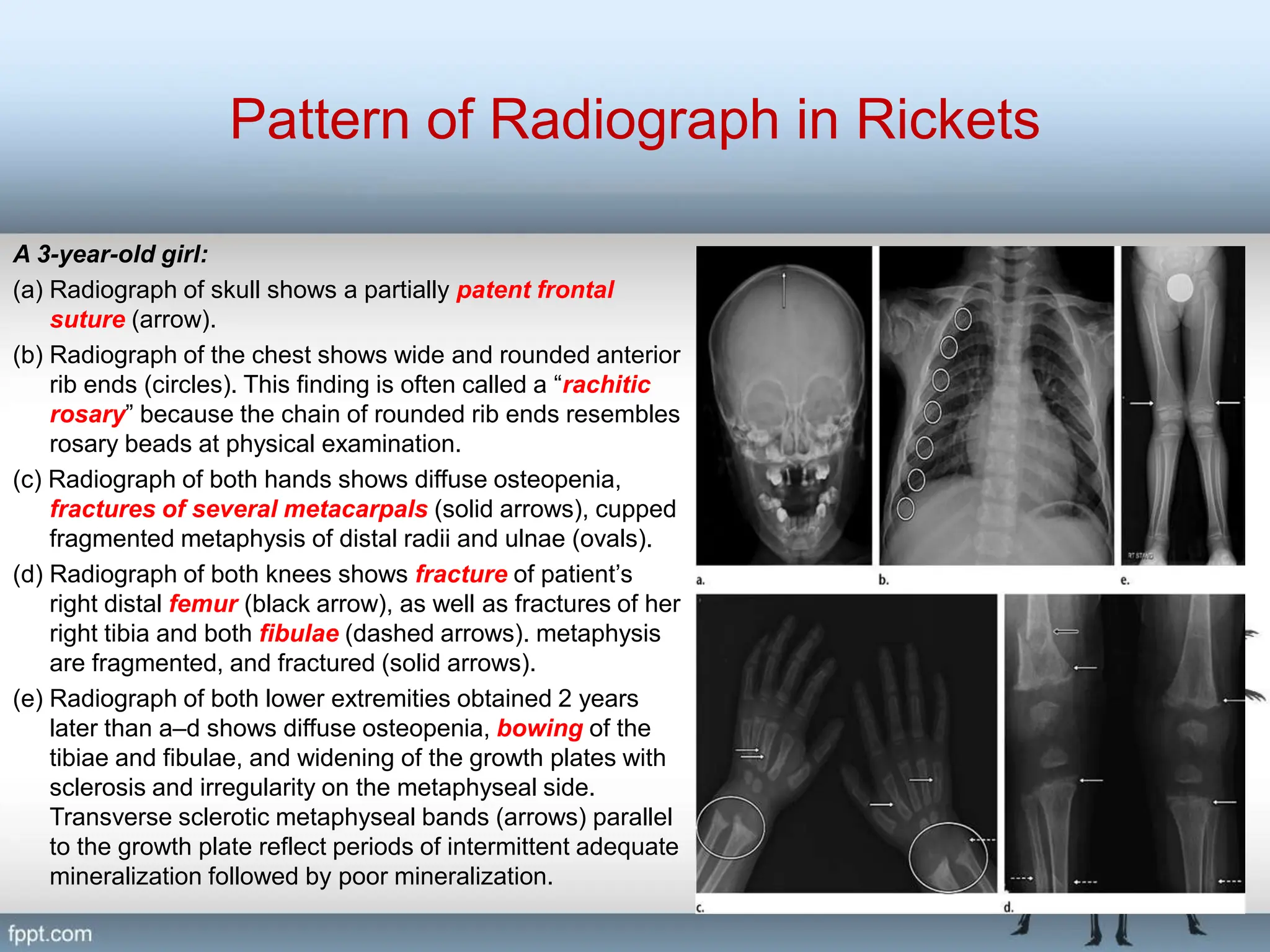 Radiograph of Skeletal System.pptmmmmmmmm | PPT