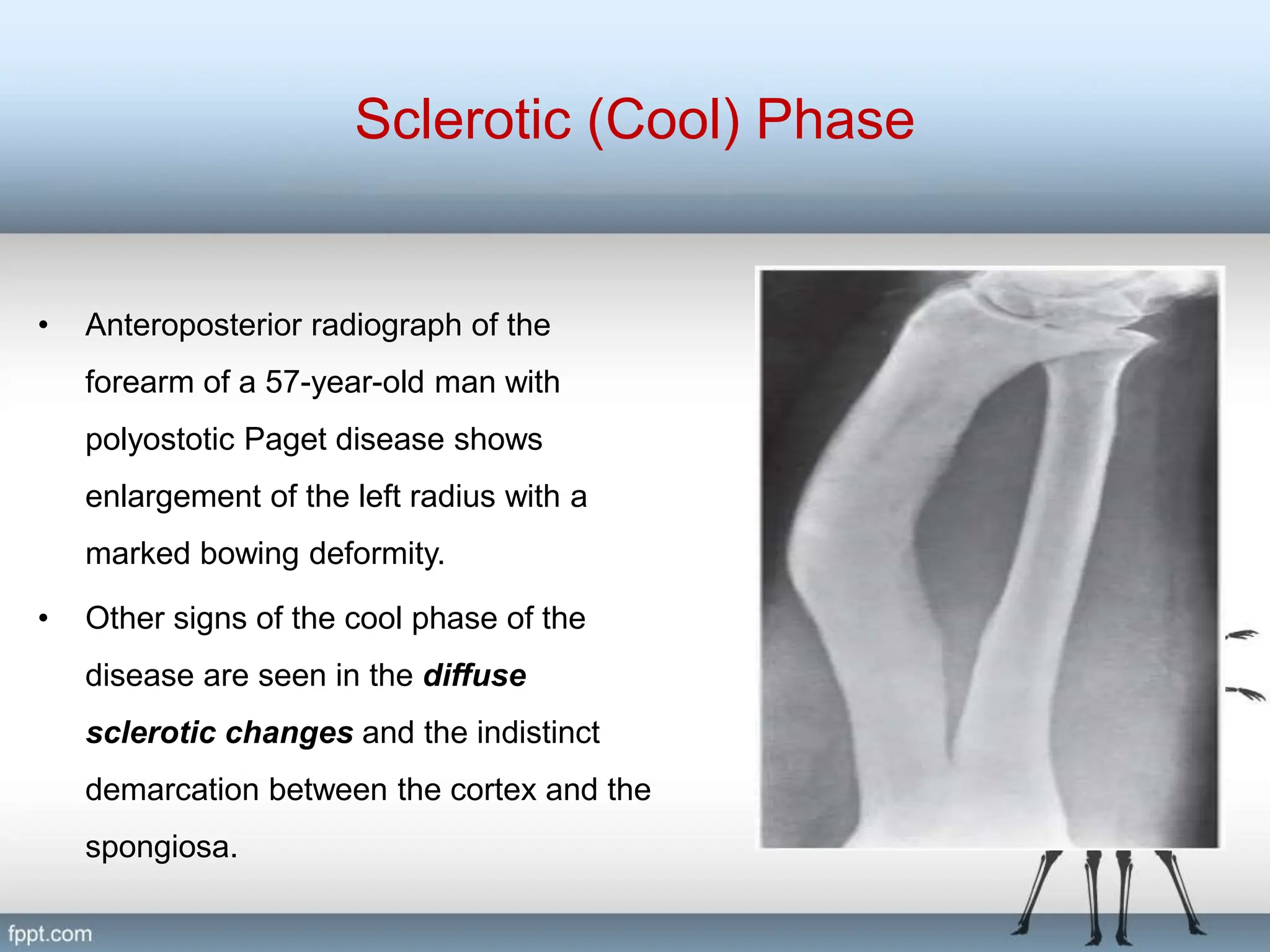 Radiograph of Skeletal System.pptmmmmmmmm | PPT