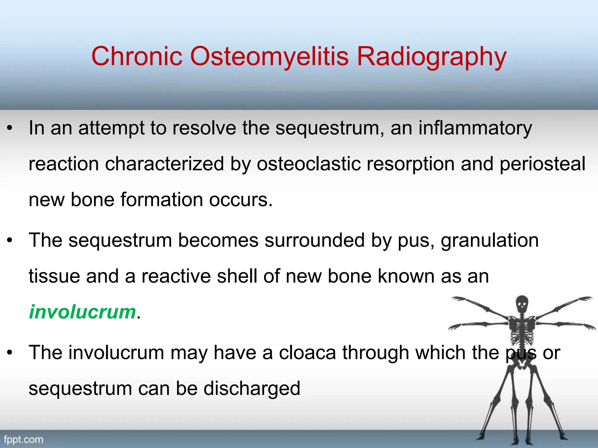 Radiograph of Skeletal System.pptmmmmmmmm | PPT