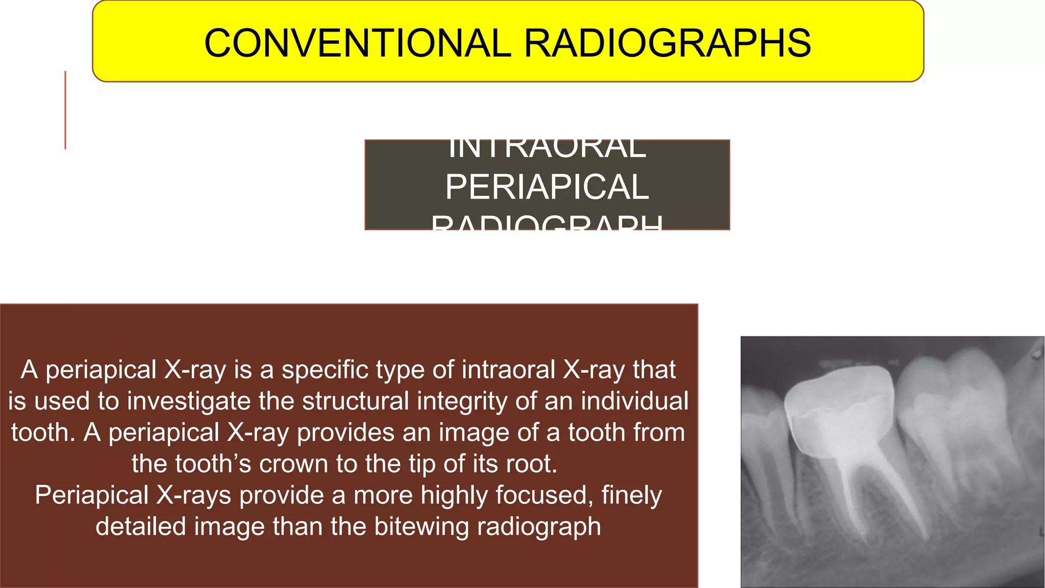 Radiographs in endodontic diagnosis | PPT
