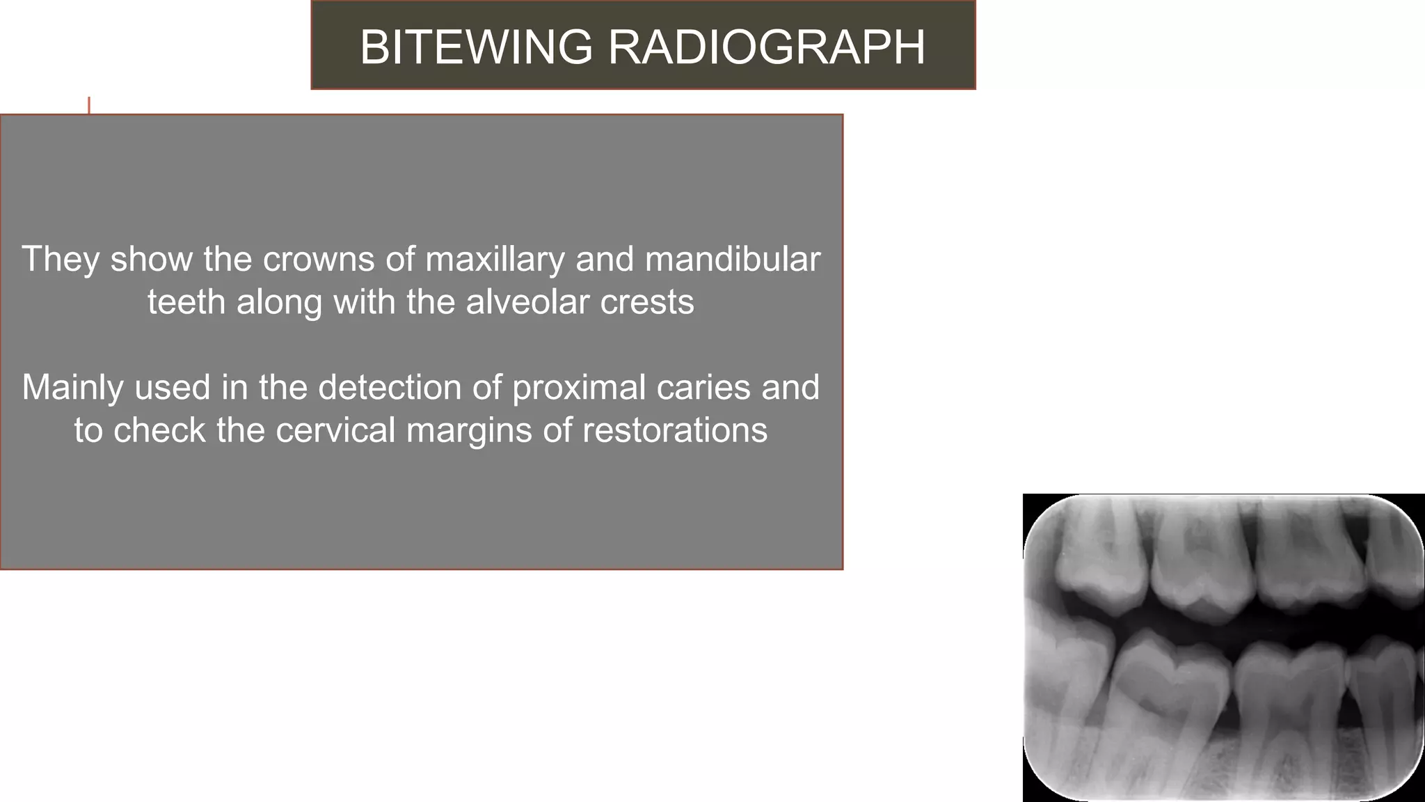 Radiographs in endodontic diagnosis | PPT