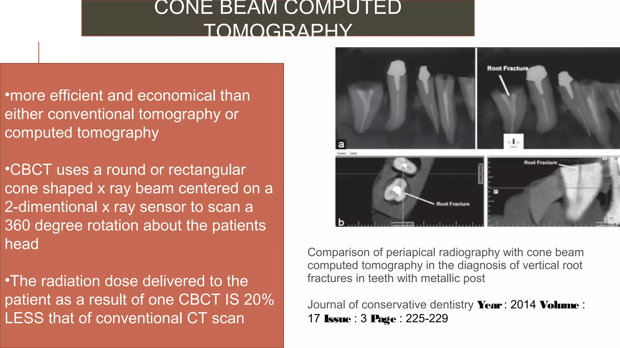 Radiographs in endodontic diagnosis | PPT