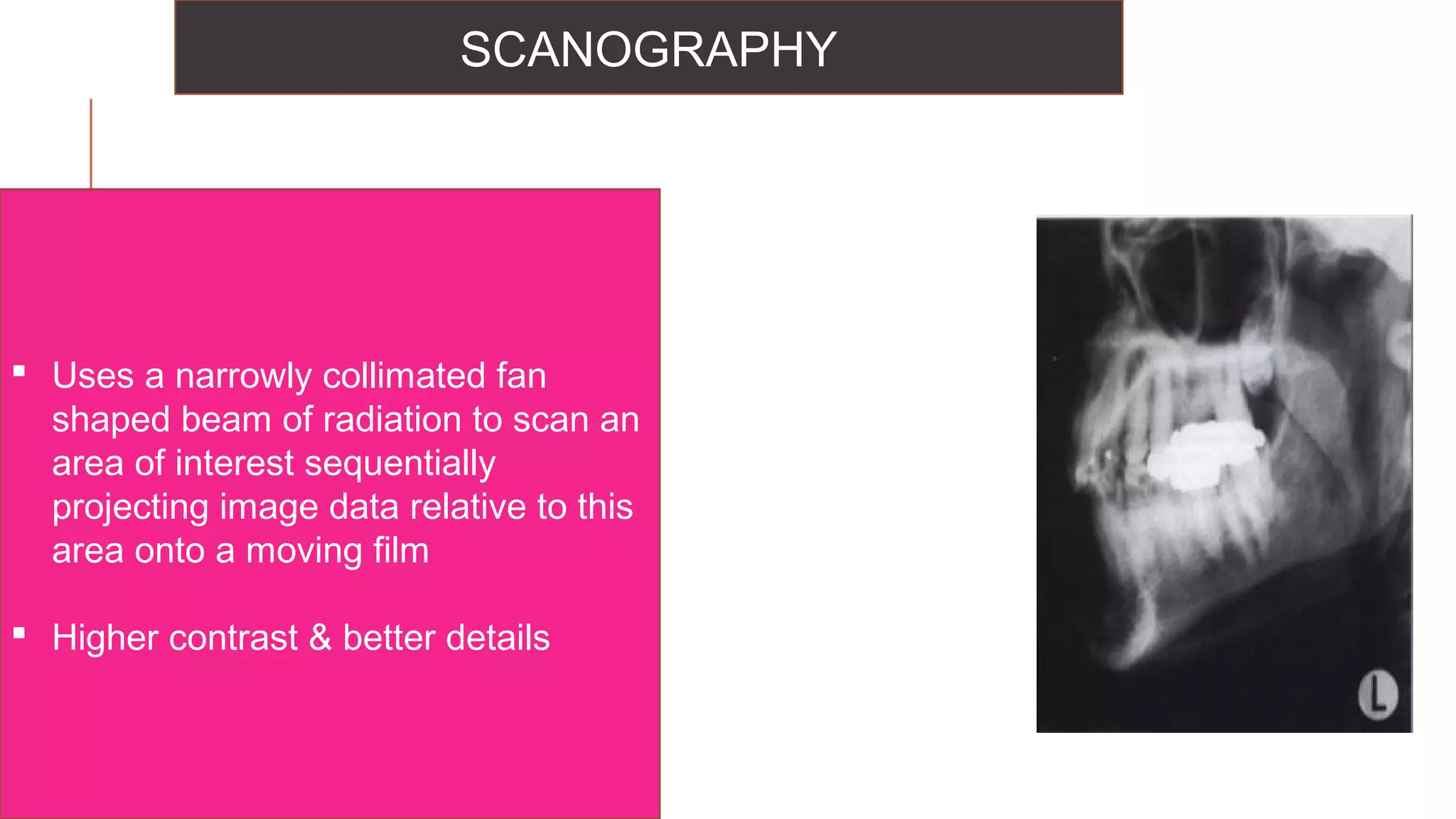 Radiographs in endodontic diagnosis | PPT