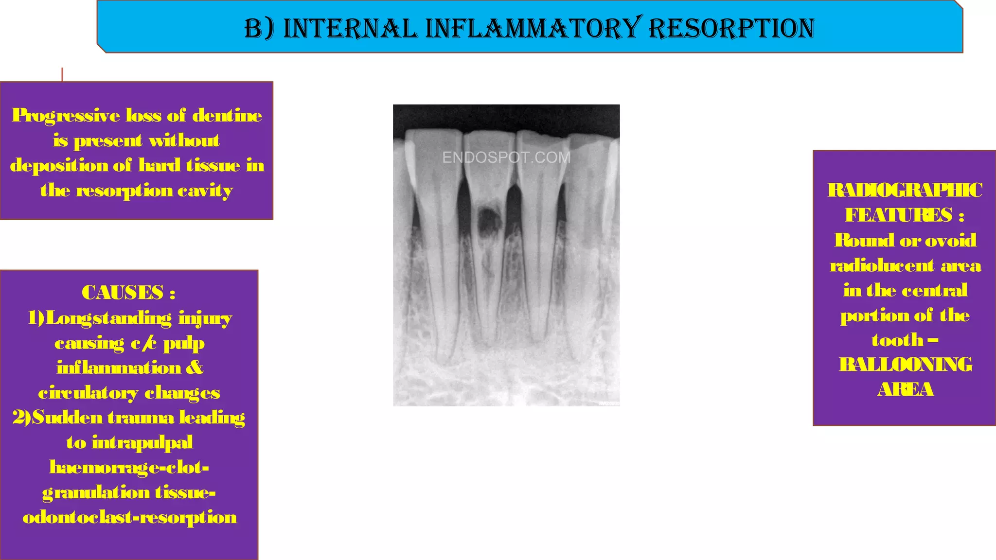 Radiographs in endodontic diagnosis | PPT