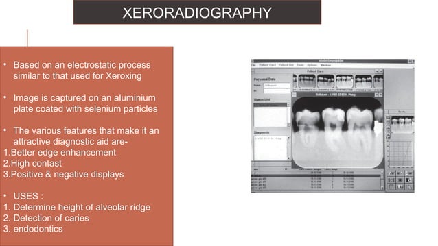 Radiographs in endodontic diagnosis | PPT
