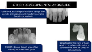 Radiographs in endodontic diagnosis | PPT