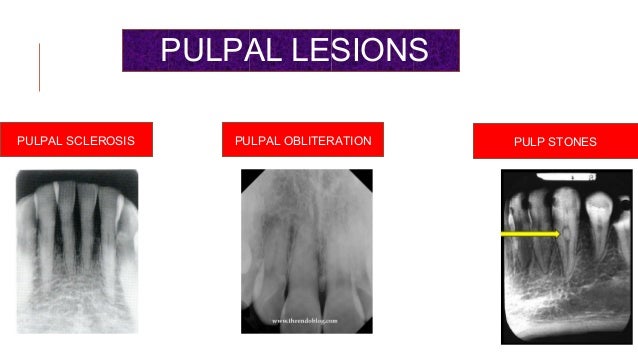 Radiographs in endodontic diagnosis