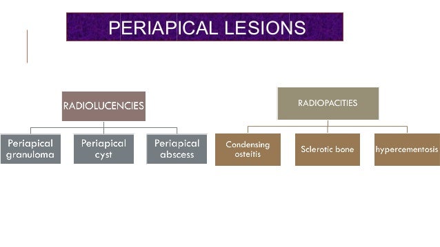 Endo Diagnosis Chart