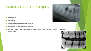 Radiographs | PPTX