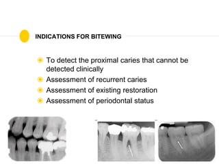 Radiographs in Operative | PPTX