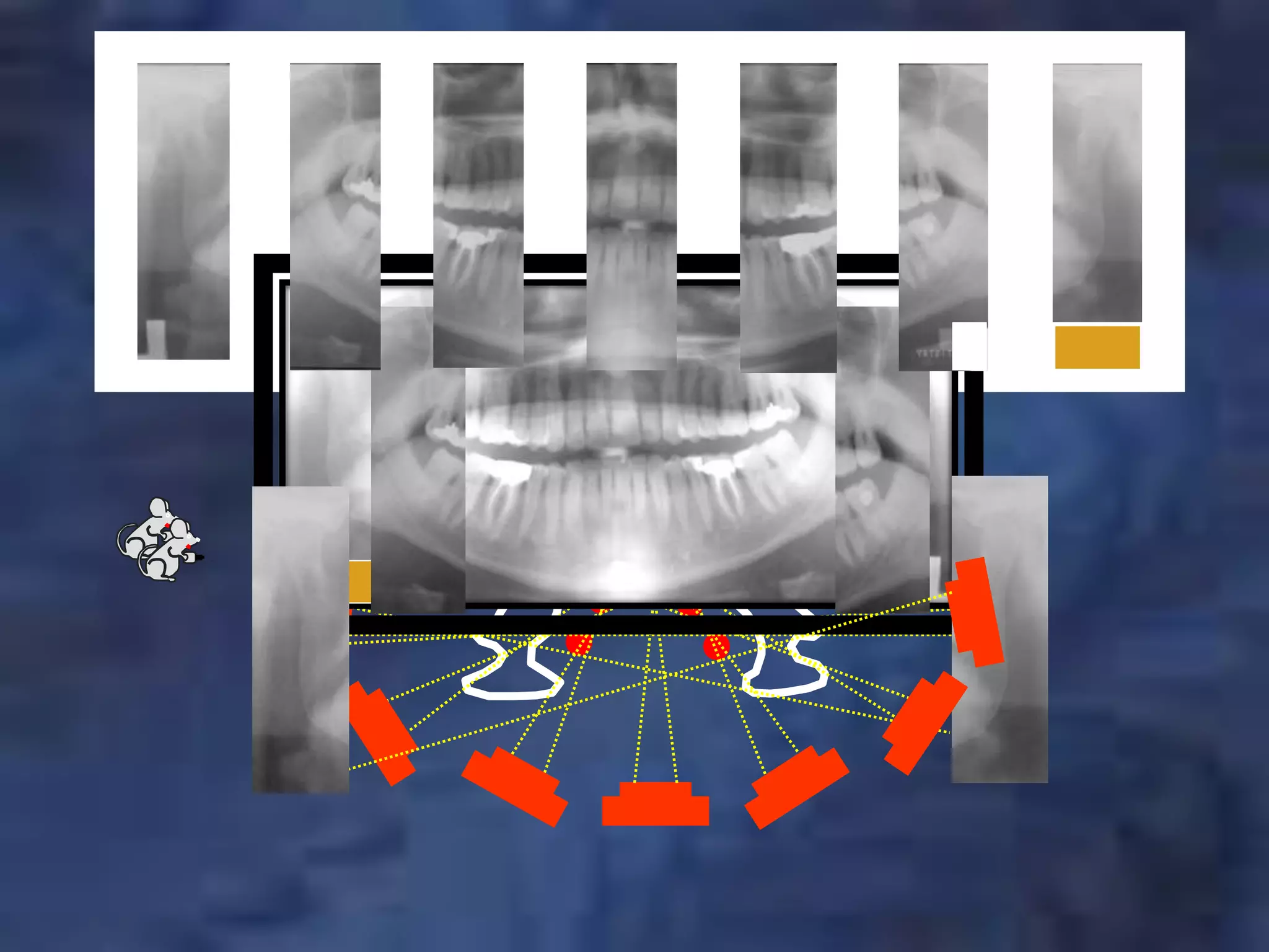 OPG and Extraoral radiography | PPTX