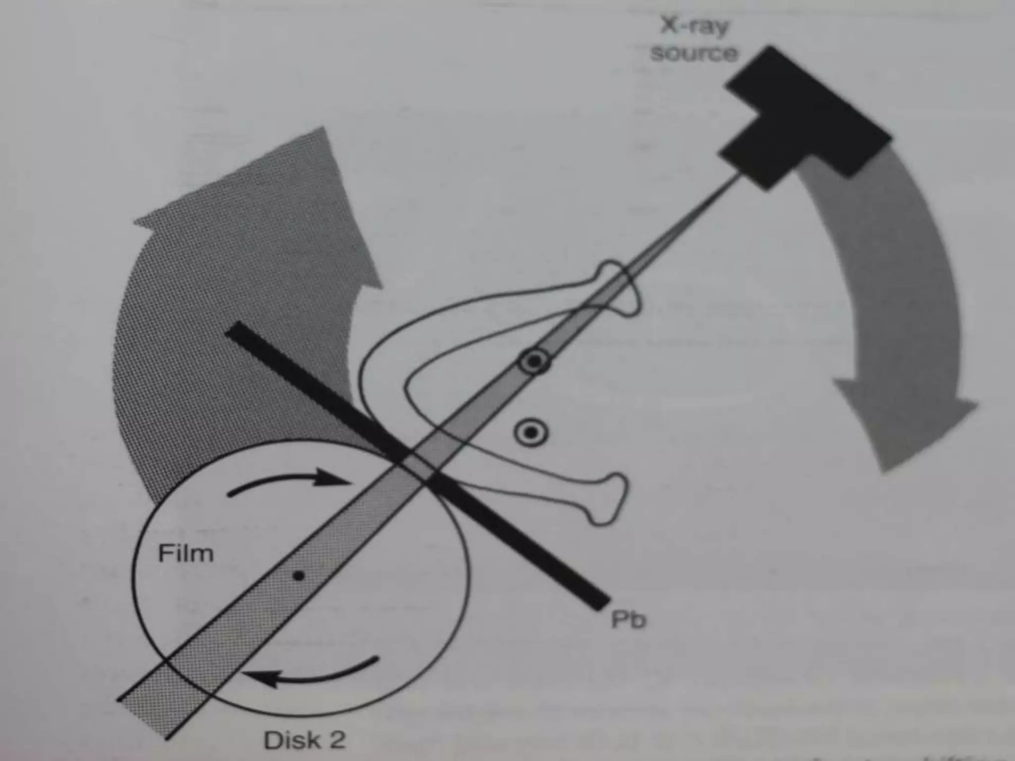 OPG and Extraoral radiography | PPTX