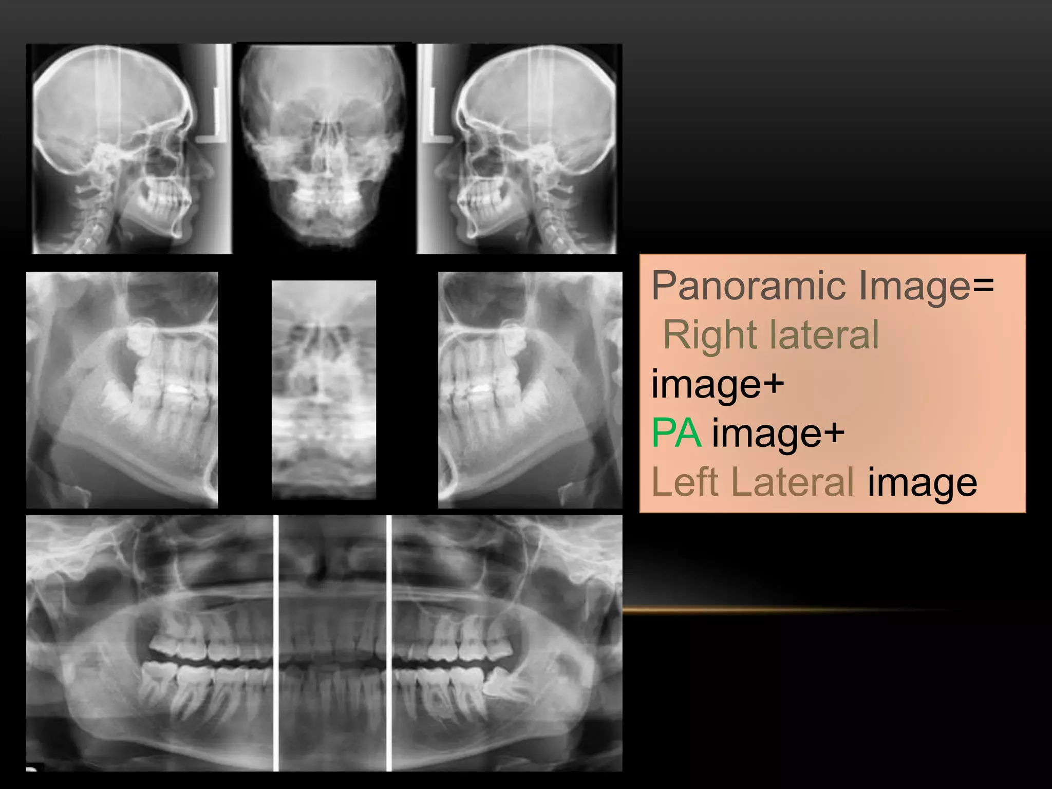 OPG and Extraoral radiography | PPTX
