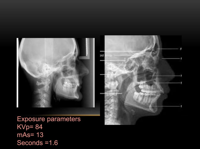 OPG and Extraoral radiography | PPTX