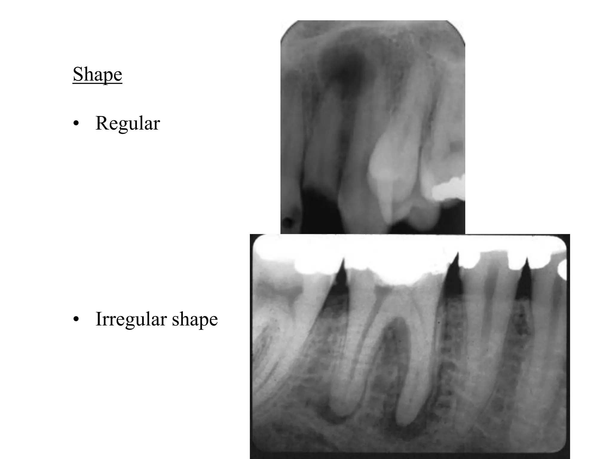 Radiographs in endodontics | PDF