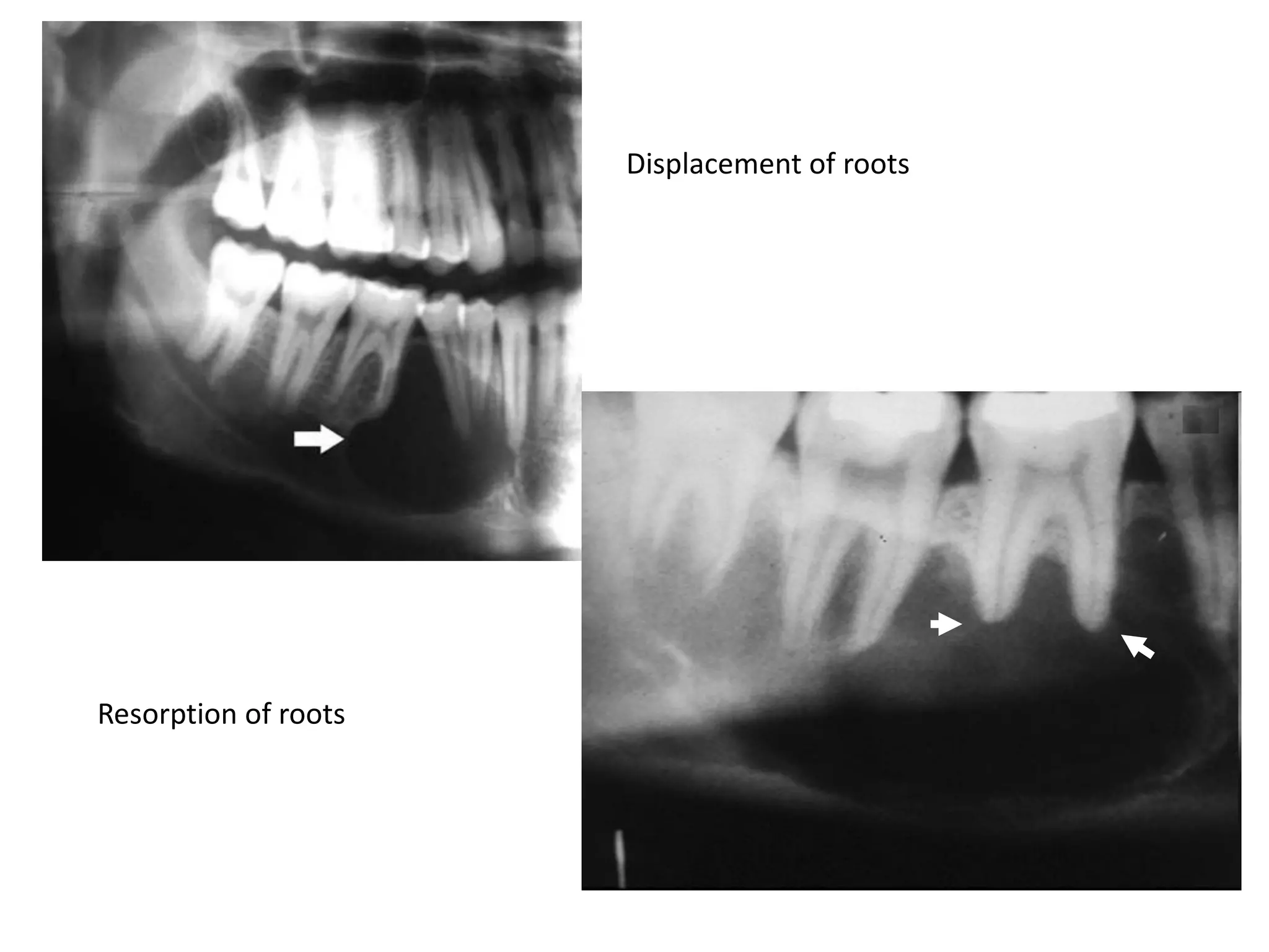 Radiographs in endodontics | PDF