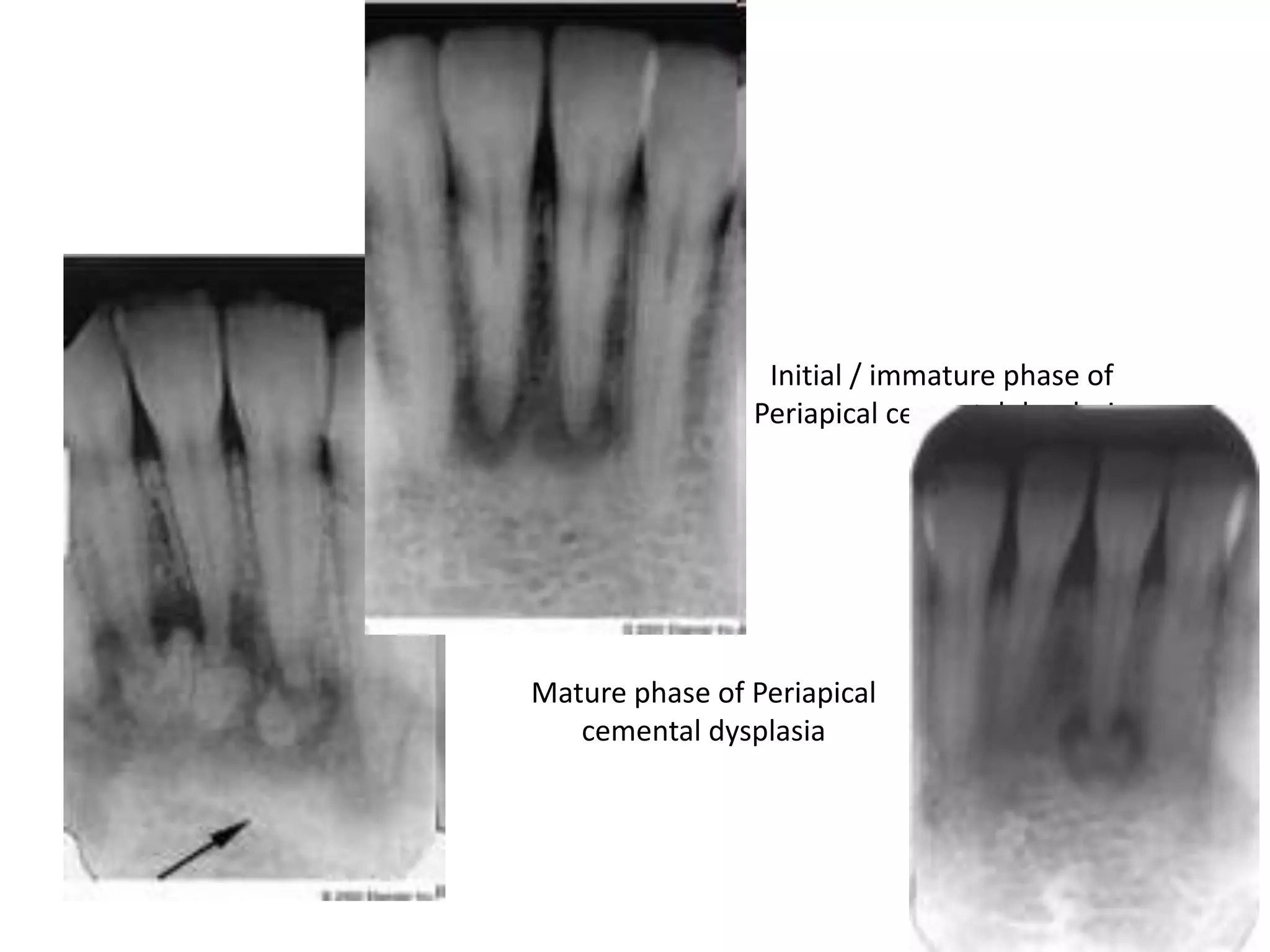 Radiographs in endodontics | PDF