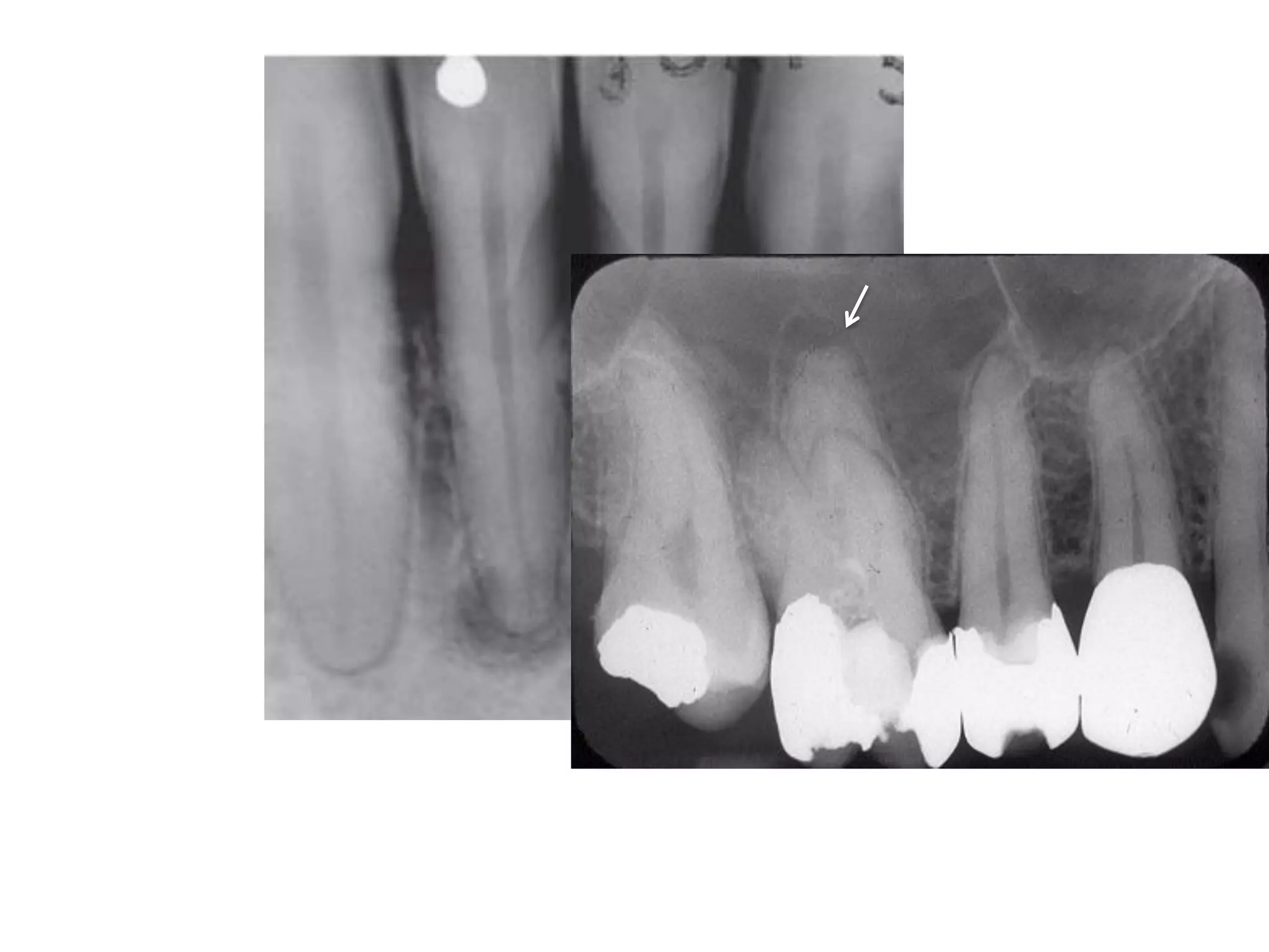 Radiographs in endodontics | PDF