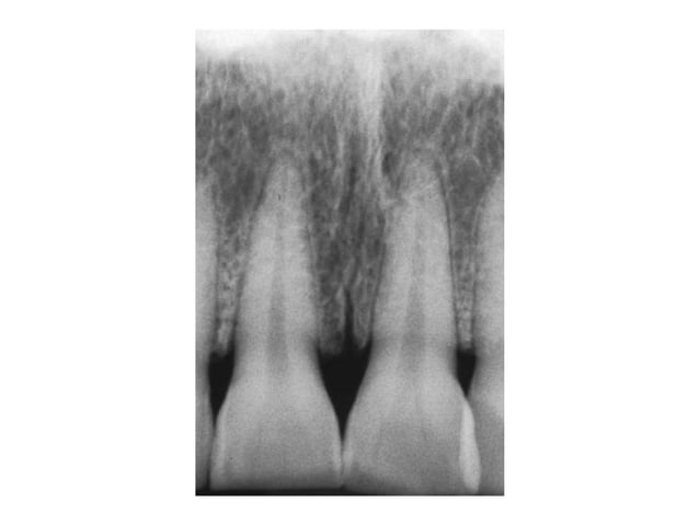 Radiographs in endodontics | PDF | Dental Health | Diseases and Conditions