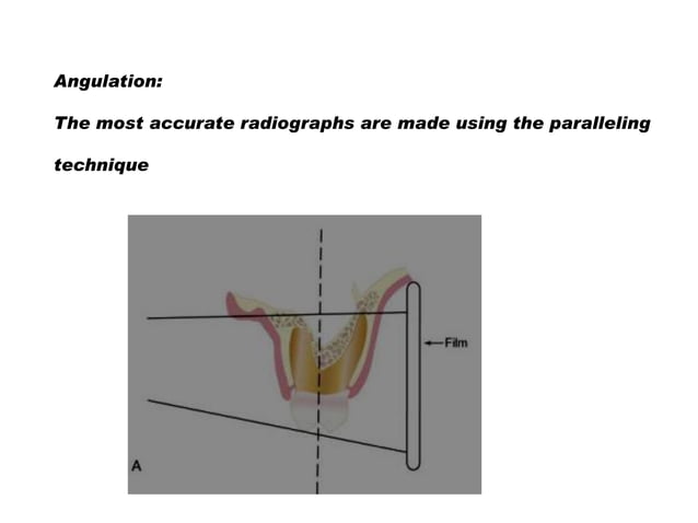 Radiographs in endodontics | PDF | Dental Health | Diseases and Conditions