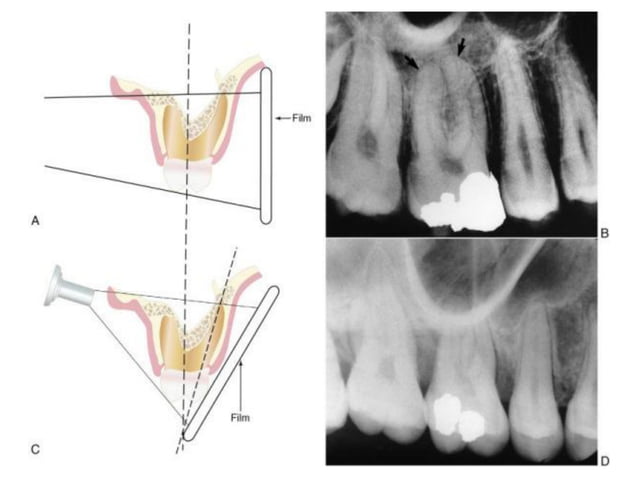 Radiographs in endodontics | PDF | Dental Health | Diseases and Conditions