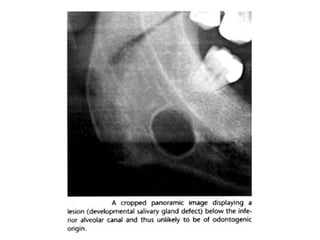Radiographs in endodontics | PDF