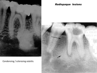Radiographs in endodontics | PDF