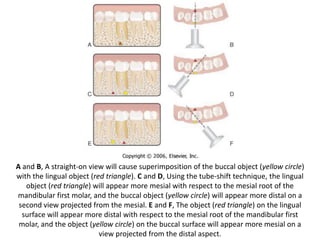 Radiographs in endodontics | PDF