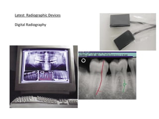 Radiographs in endodontics | PDF | Dental Health | Diseases and Conditions