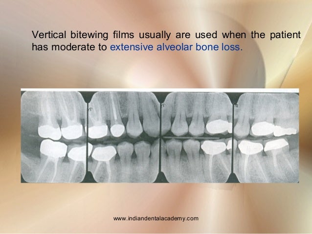 Radiograph techniques & landmarks