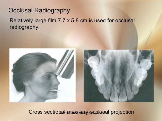Radiograph techniques & landmarks