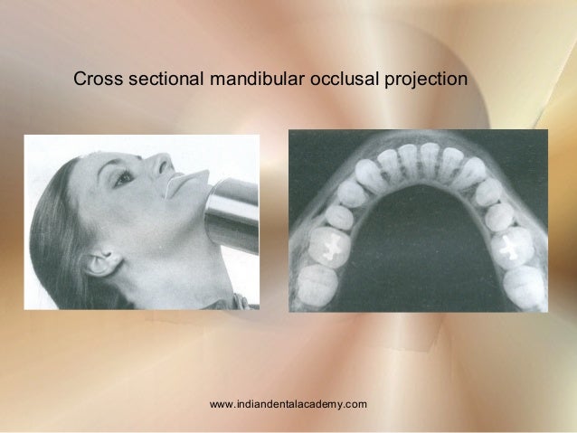 Radiograph techniques & landmarks
