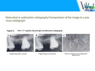 Radiography | PPTX | Medical Tests | Medical Health