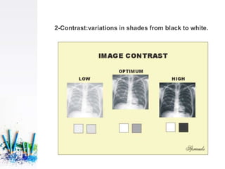 Radiography | PPTX
