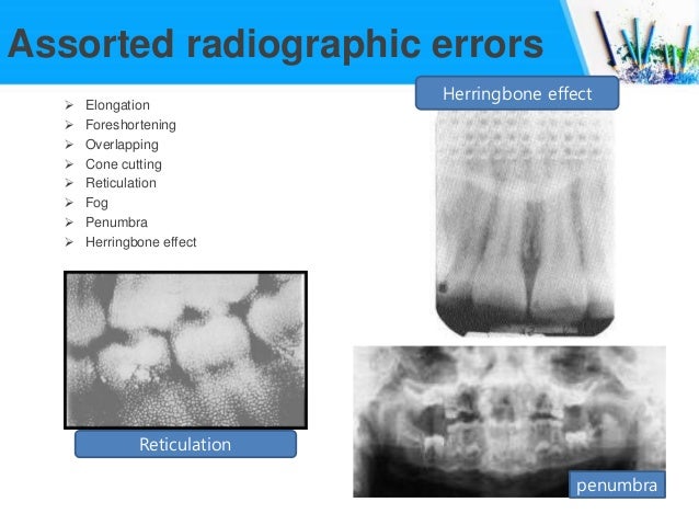 Radiography
