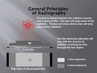 Technical seminar on Introduction to RADIOGRAPHY.pptx | Physics | Science