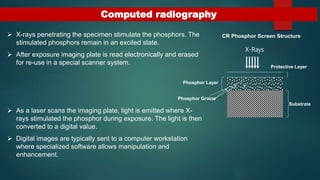 Radiography | PPTX
