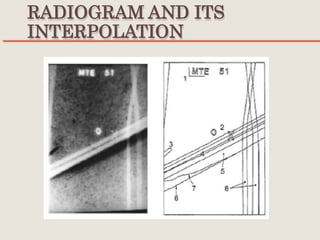 NDT by Radiography in Civil Engineering | PPTX