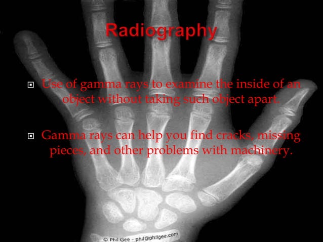 Radiography final | PPT